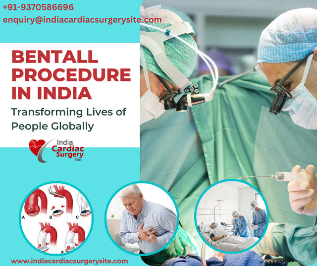 Bentall Procedure In India Transforming the Lives of People Globally ...
